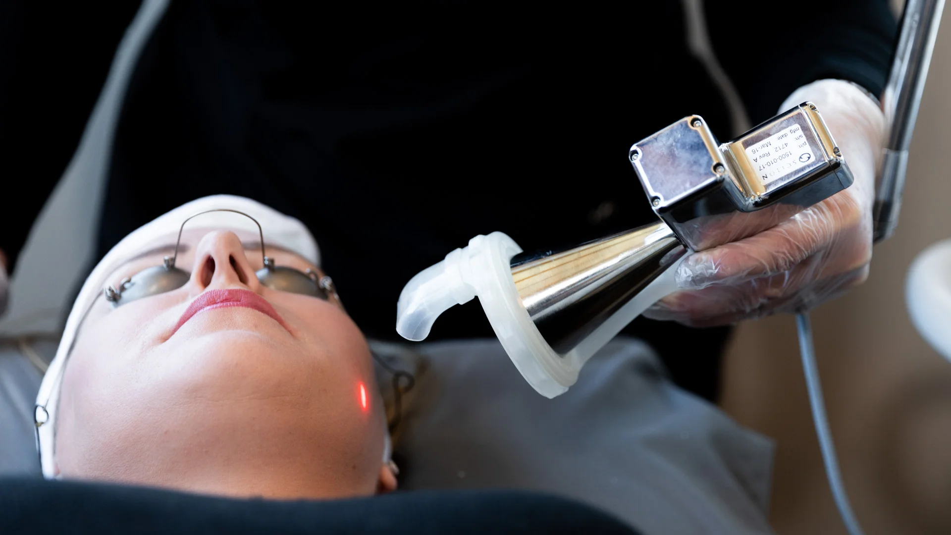 MicroLaser Peel Treatment In Annapolis, MD | Euna Aesthetics